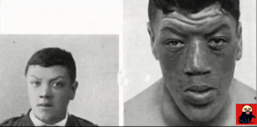 É possível ser um anão e um gigante? Adam Rainer mostrou que sim - Minilua